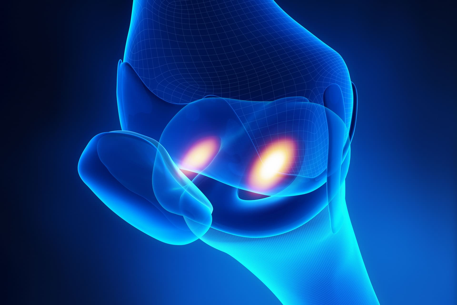 Ρευματοειδής αρθρίτιδα - Αυτοάνοση αρθρίτιδα - Αντιμετώπιση